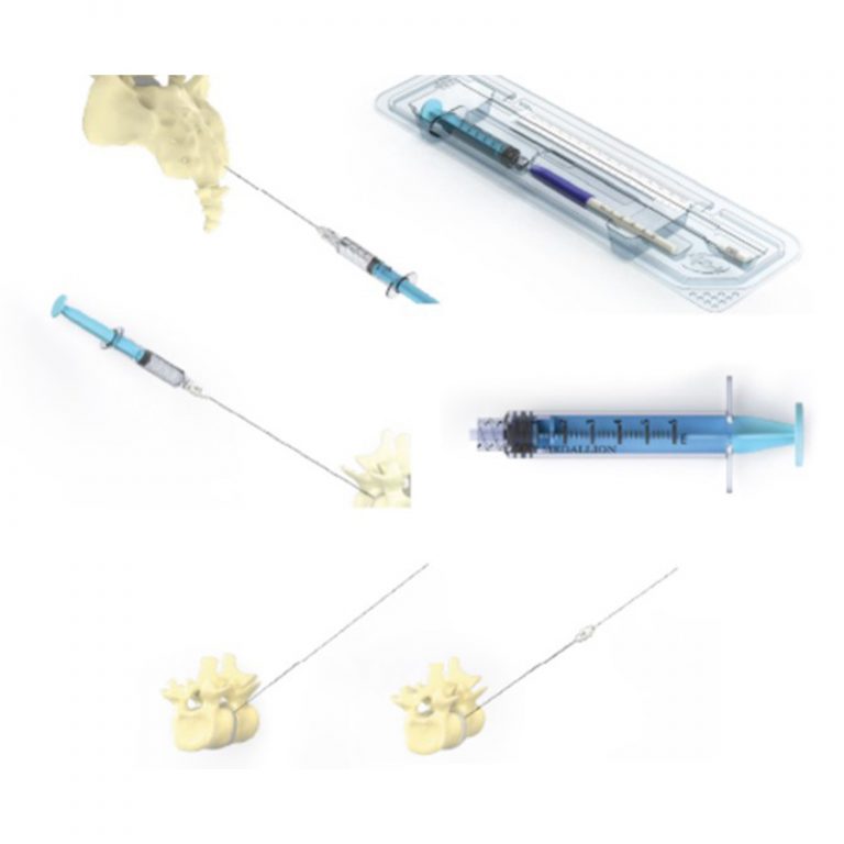 Craniofix – INSUMEDIC